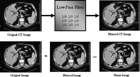 Image Postprocessing In Digital Radiology—a Primer For Technologists
