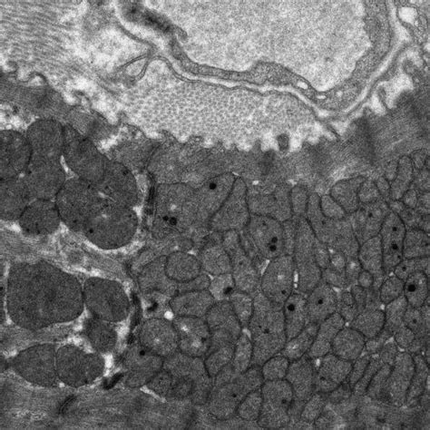 Ultrastructure Of Individual Cardiomyocyte Mitochondria In A