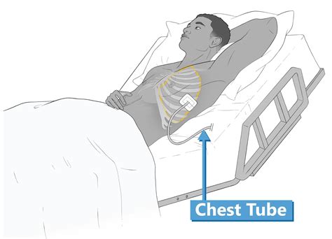 Chest Tube Tutorial Nursing Interventions And Drainage Video