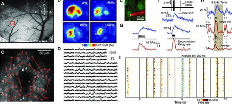 Temporally Deconvolved Calcium Imaging In The Mouse Auditory Cortex A