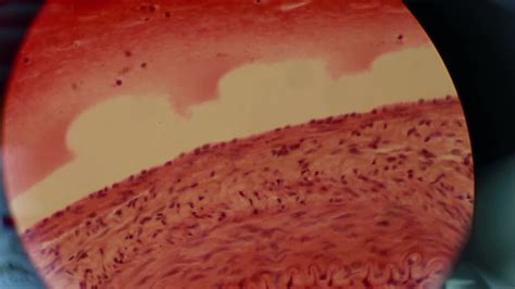 Imágenes De Eimeria Descubre Bancos De Fotos Ilustraciones Vectores Y Vídeos De 58 Adobe Stock