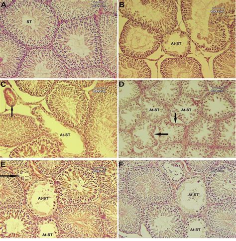 Transverse Sections Of Testicular Tissue In Experimental Groups A