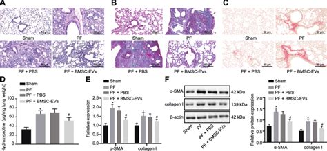 Bmsc Evs Suppresses Ipf In Vivo Ac He Staining A Masson Staining