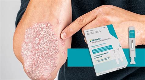 Ucb Picks 20 Sps For Its Sub Q Psoriasis Tx Bimzelx Anton Health