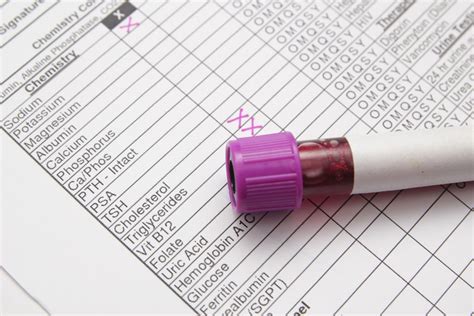 Good Cholesterol May Be Bad For Some People Live Science