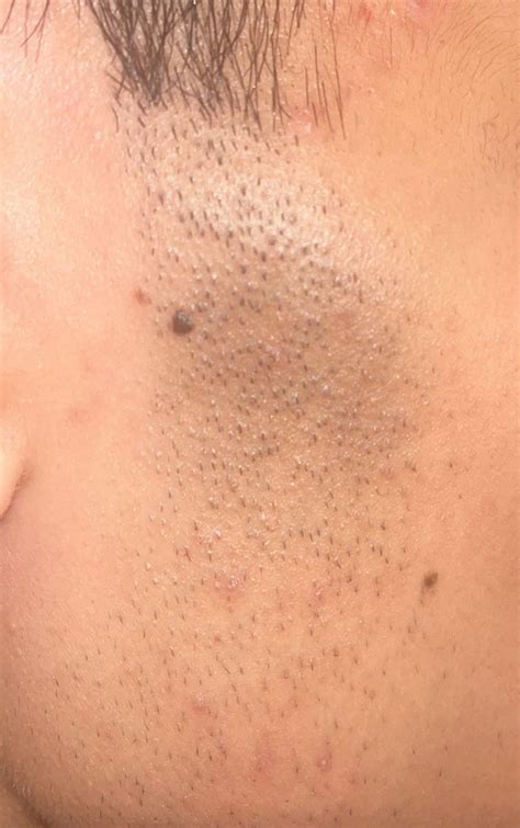 how do i get rid of this green tint after shaving r mensgrooming