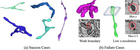 Mitoem Dataset Large Scale 3d Mitochondria Instance Segmentation From Em Images Pmc