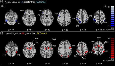 Neural Signal For Nonsymbolic And Symbolic Addition Relative To Their Download Scientific