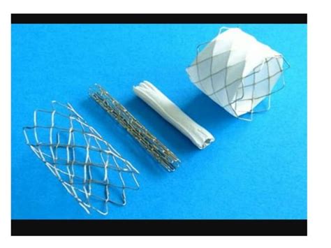 Cxr Findings In Cardiology Pptx Heart And Cardiovascular Diseases Diseases And Conditions