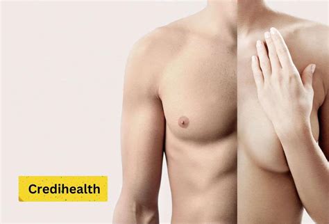 Gender Reassignment Surgery Procedure Benefits And Risks Credihealth