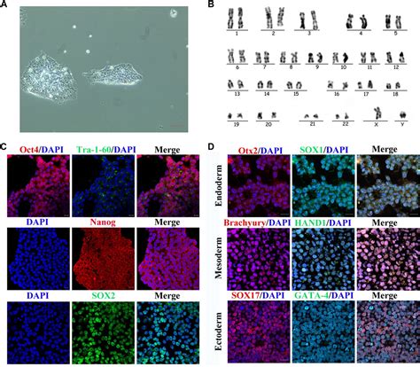 Frontiers Safety And Biodistribution Of Exosomes Derived From Human Induced Pluripotent Stem Cells