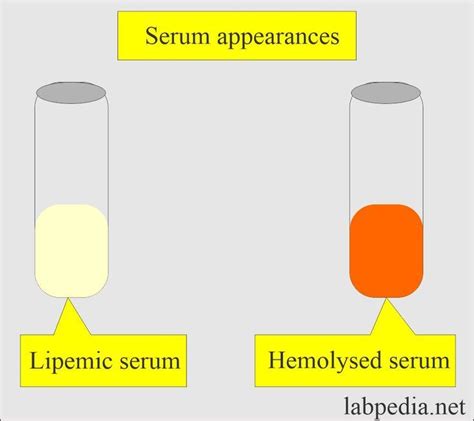 Common Lab Errors And Effect Of Various Anticoagulants On Tests Anticoagulant Lab Pathology Lab Common Lab Errors And Effect Of Various Anticoagulants On Tests Anticoagulant Lab Pathology Lab