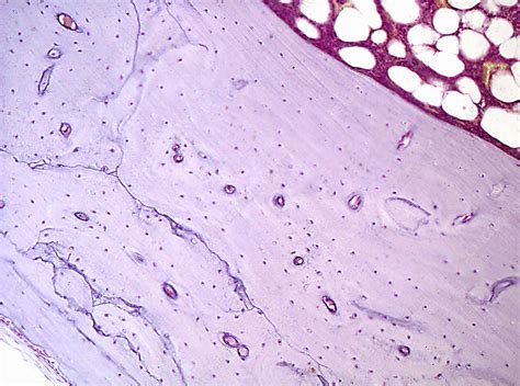 Immature Compact Bone Decalcified Lm Stock Image C030 5070