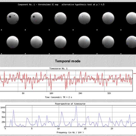 Independent Component Analysis Ica Of The Birn Phantom Scan Top