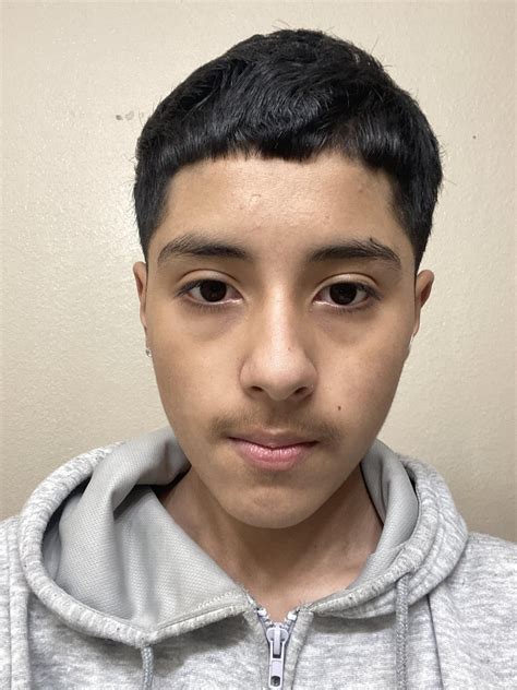 14 Male Have Been Suffering From Dry Eyes For Like 3 Years I Tried Eye