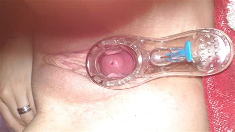 Cervix Porn Pics Pictoa