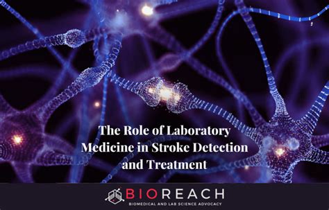The Critical Role Of Laboratory Medicine In Stroke Detection And Treatment Bio Reach