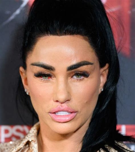 Katie Price Grins As She Shows Off Full Effect Of Healed £10000 Face