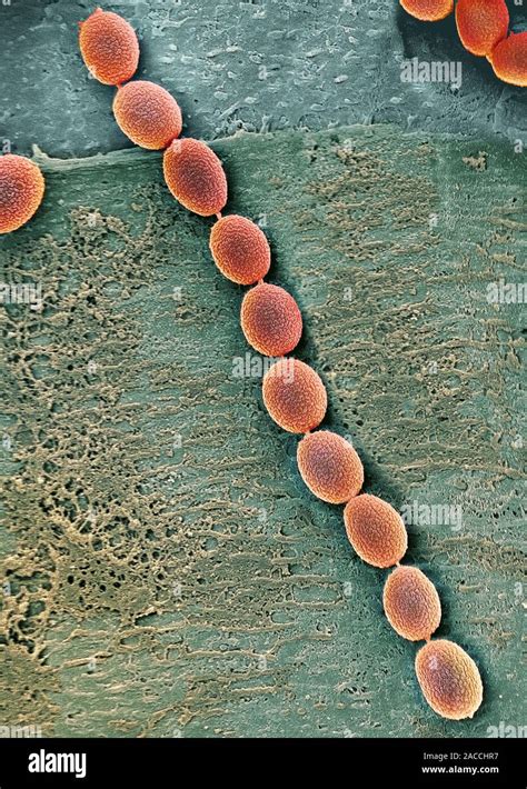 Fungal Spores Coloured Scanning Electron Micrograph Sem Of The Spores Of A Fungus Red On
