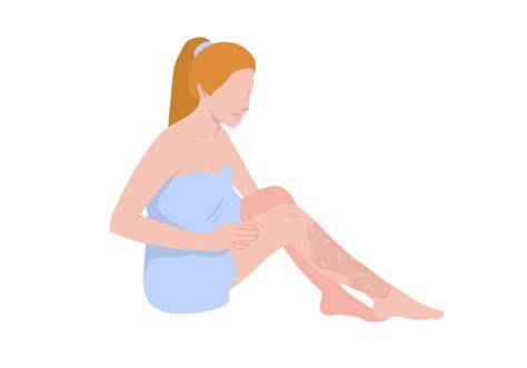 Cellulitis Know The Symptoms Of Cellulitis And Seek Treatment