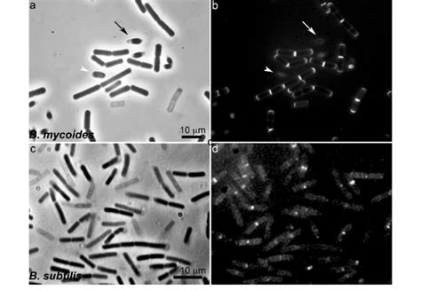 View Of B Mycoides Sin And B Subtilis Cells From Germinated Spores
