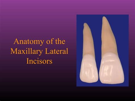 Maxillary Lateral And Mandibular Incisors Ppt Dental Health