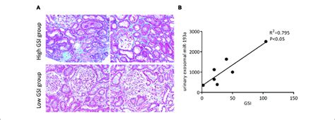 Prognostic Values Of Urine Exosomal Mir 193a Levels In Patients With