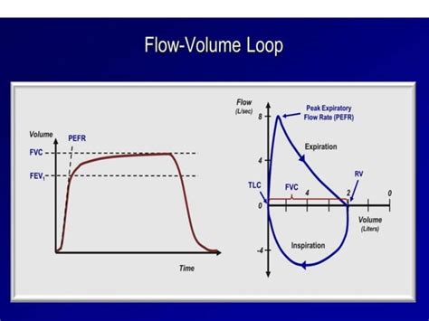 Interpretation Of Pulmonary Function Test PPTX Lung And Respiratory Health Diseases And