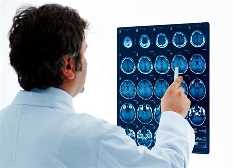 Can A Ct Scan Show Dementia Is Mri Better Readementia