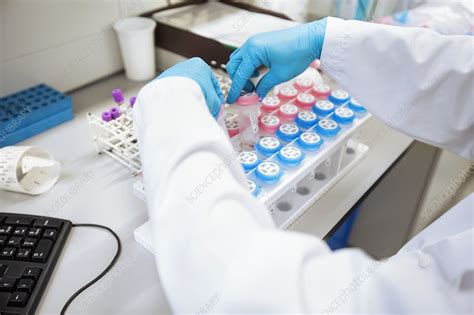 Genetic Analysis Sample Preparation Stock Image C019 0260 Science Photo Library
