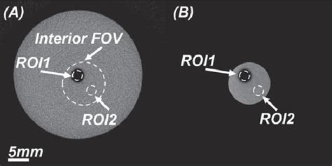 Position Of Rois For Cnr Evaluation In Water Phantom Datasets Roi1