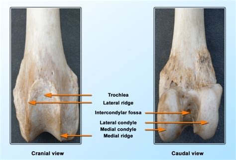 Trochlea Femur
