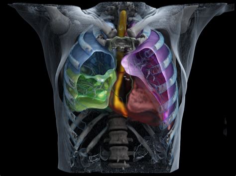 Autocontouring In Radiation Therapy Siemens Healthineers Siemens Healthineers