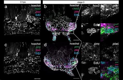 This Worm Can Regrow Its Body By Reversing To A Stem Cell Like State