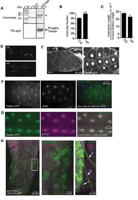 Figure 2 From Altered Gene Regulation And Synaptic Morphology In