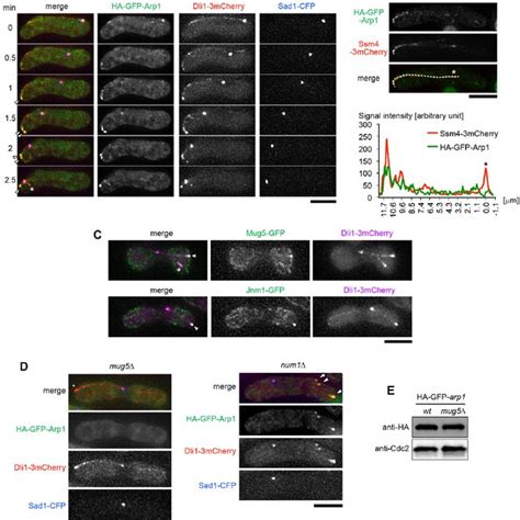 Loss Of Dynein Motor Activity Affects Localization And Cortical Download Scientific Diagram