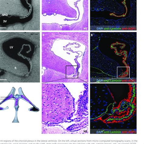Attachment Regions Of The Choroid Plexus In The Fourth Ventricle And