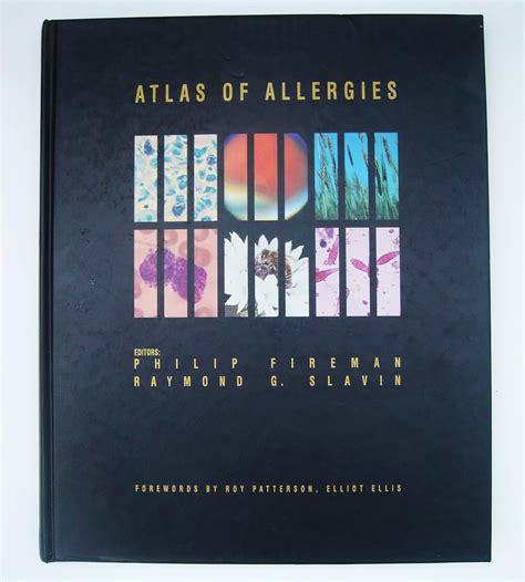 Atlas Of Allergies 9780397446698 Books