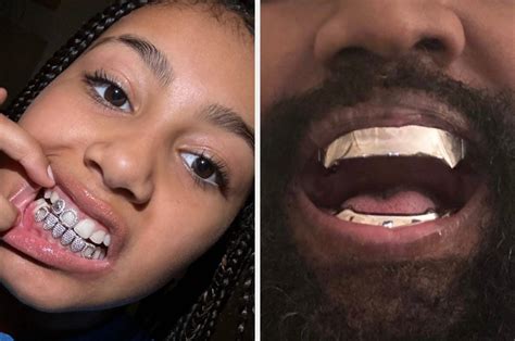 North West Shows Off Teeth Prove Magazine