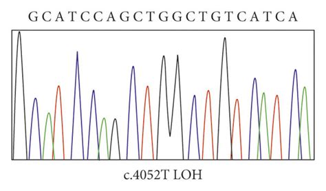 Wild Type A And Patient Electropherogram Showing The Germline