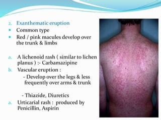 8 Drug Eruption And Urticaria Pptx