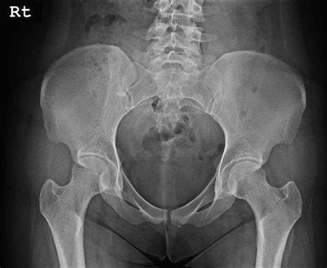 Bandm 트레이닝센터 2018년 대한카이로프랙틱학회 학술회가 10월 28일 12~17시까지 진행됩니다 요통을 위한 운동 하지재활운동 어깨충돌증후군을 위한 Fmet운동