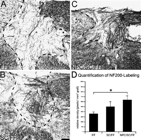 Axonal Growth Is Enhanced Into Schwann Cell Containing Grafts Download Scientific Diagram