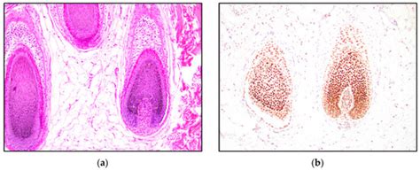 trps1 a marker of follicular differentiation