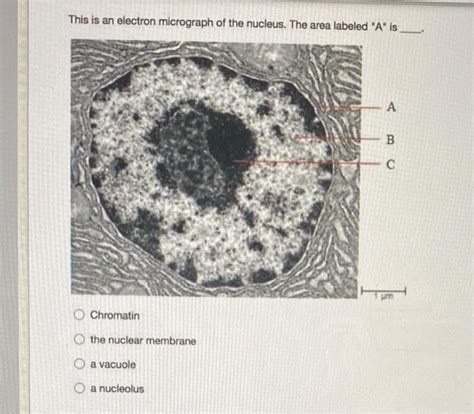 Solved This Is An Electron Micrograph Of The Nucleus The Chegg