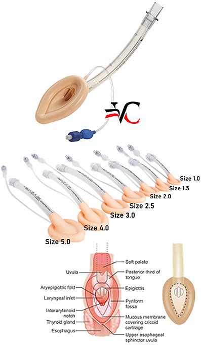 Laryngeal Mask Airway Insertion