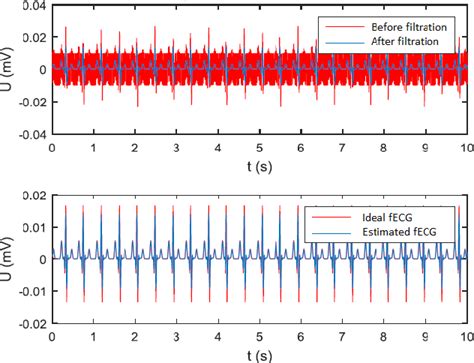 Figure 3 From Fetal Ecg Preprocessing Using Wavelet Transform
