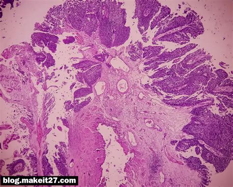 의학용어 Tcc Va Rml 블로그잇27