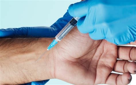 Le Blog Arthrose Du Pouce