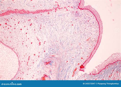 Tooth Development From Human Under Microscope Stock Image Image Of Inflammation Development